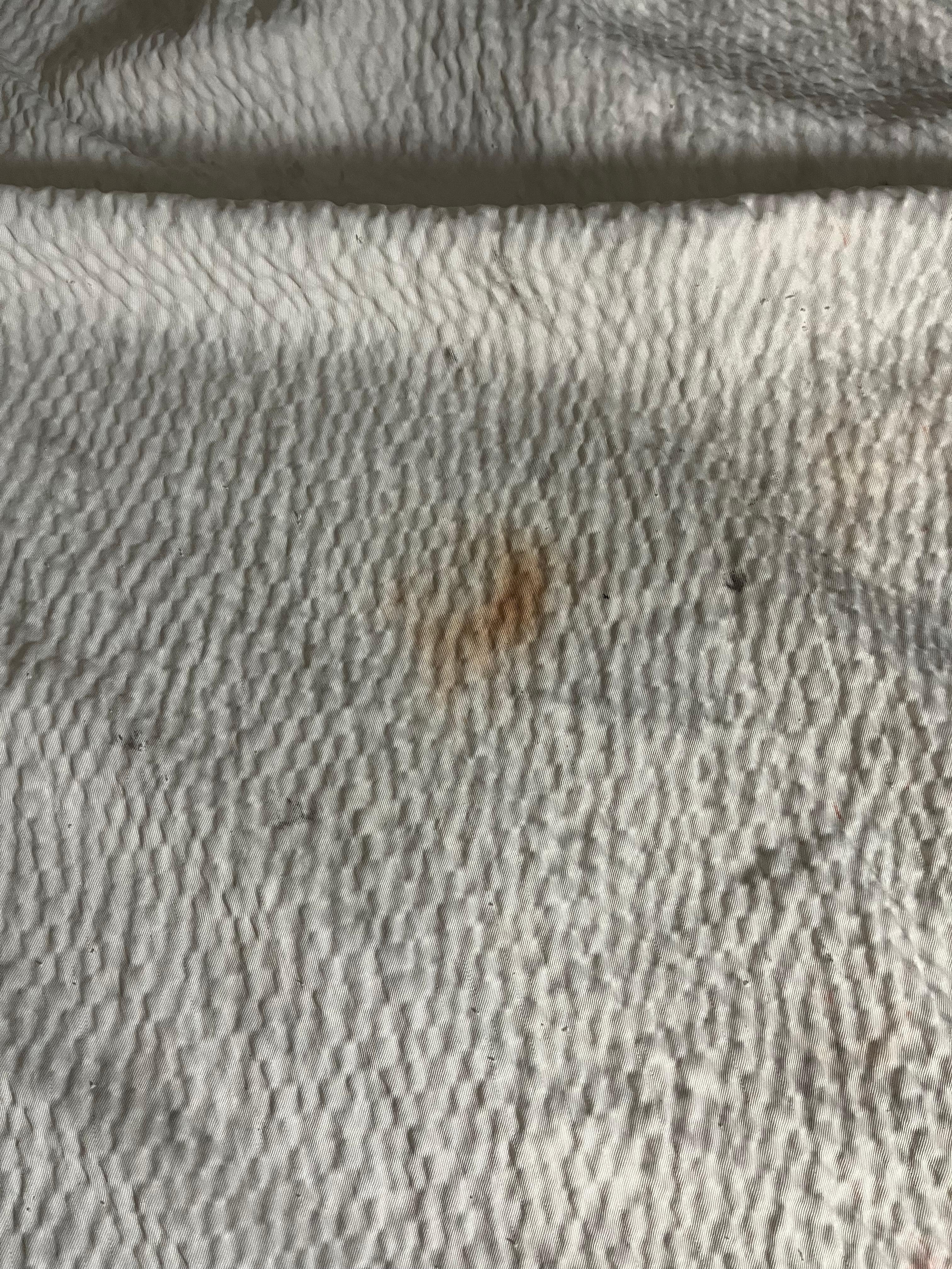 Blood stains on blanket?