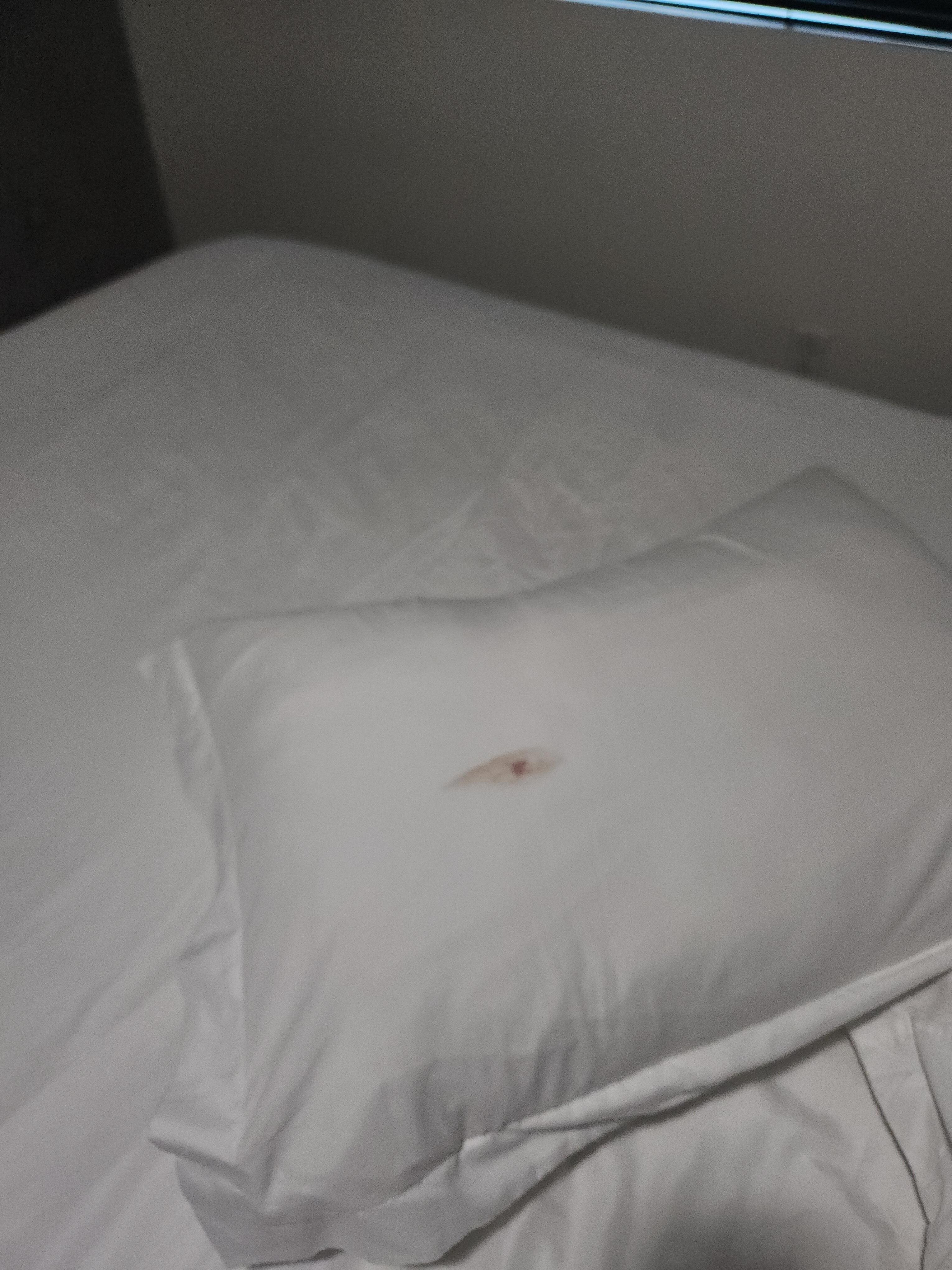 Literal blood on the pillow