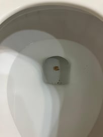 This is the condition of the clean restroom in the hotel that we just checked into