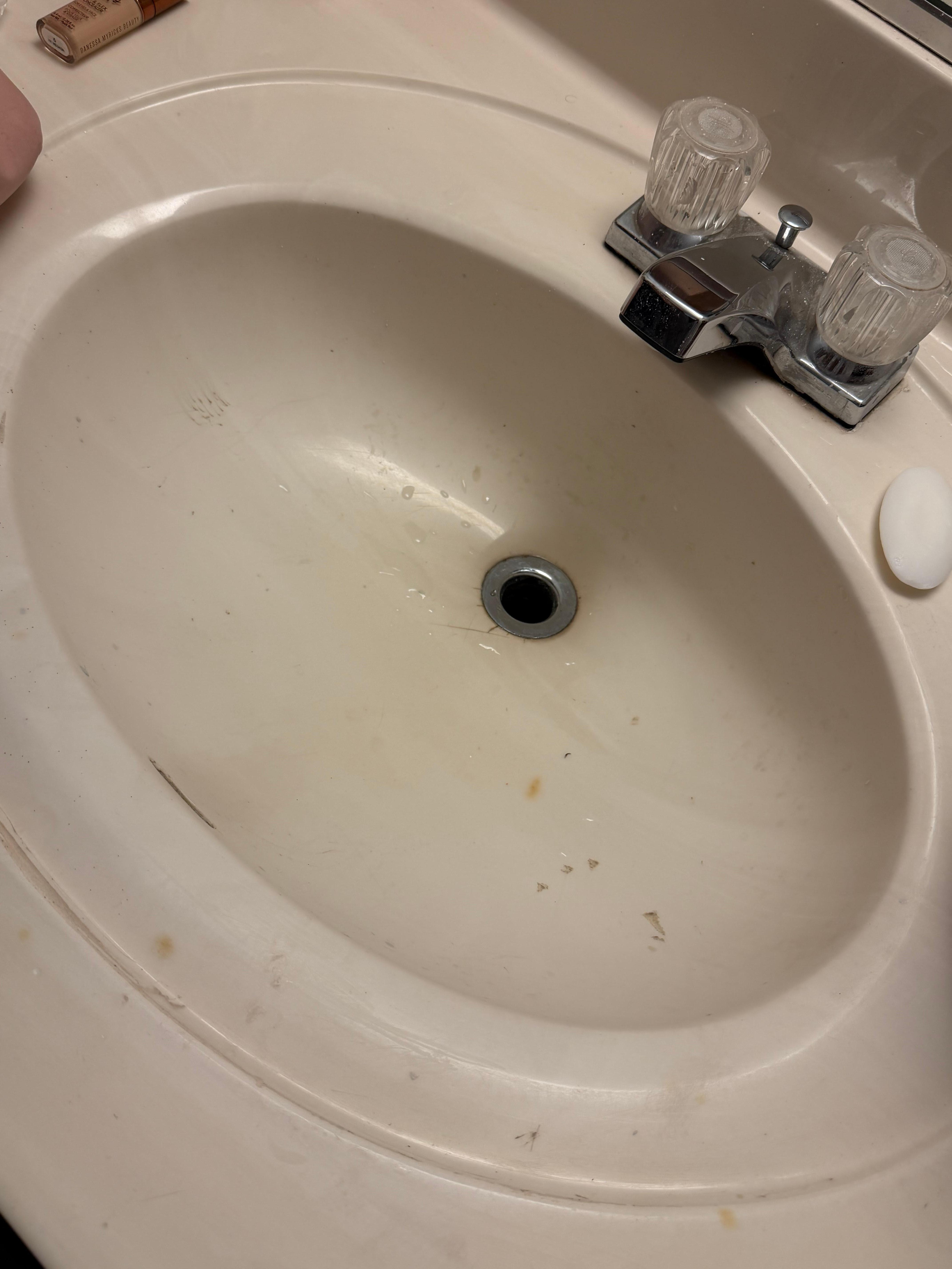 Filthy sink. 