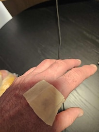 The staff at check-in gave him a bandaid.