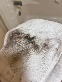 This is the condition of the floor outside of the bathroom. Black dog hair and dirty floors everywhere. I didn’t have the stomach wipe the rest of the room.