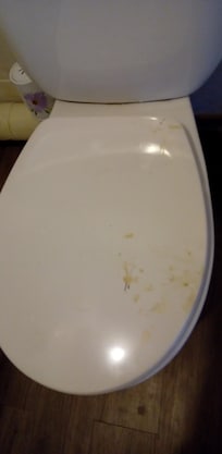 La lunette des WC à besoin d être remplacée...comme beaucoup de choses dans cet hotel malheureusement...