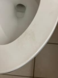 Dirty toilet seat