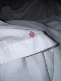 Blood stained sheets! Disgusting.
