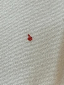 Blood on the sheets