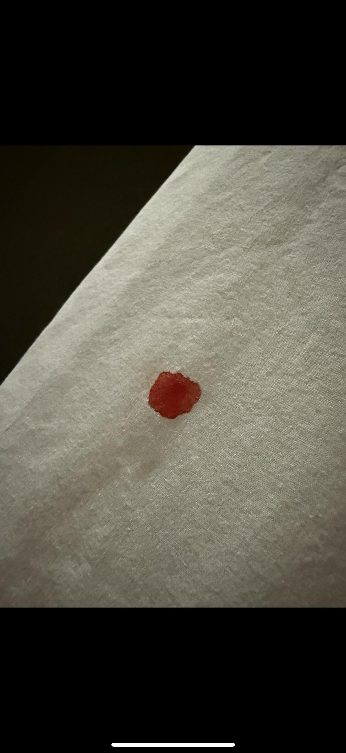 Blood on the sheets 