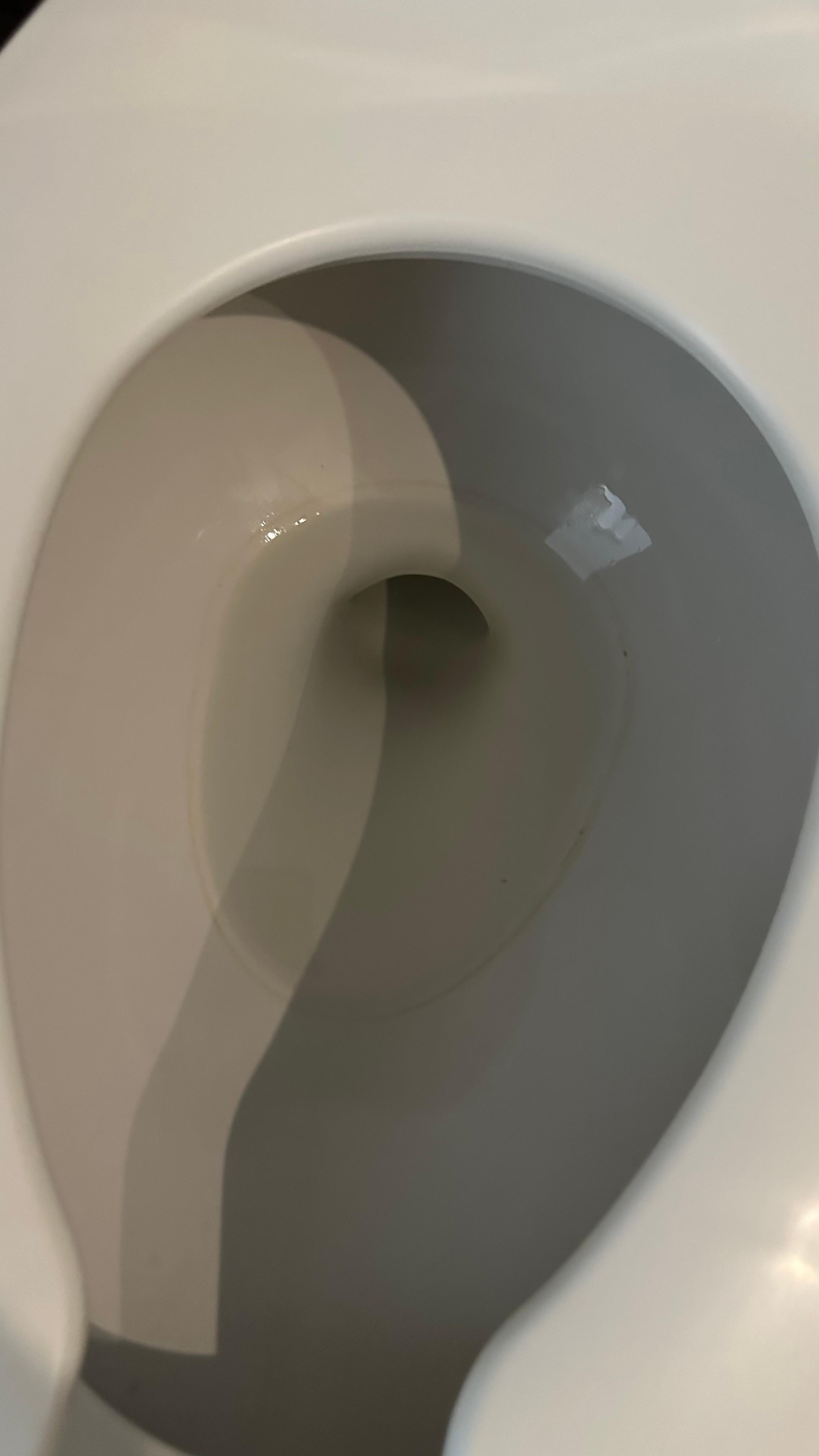 WC sucio