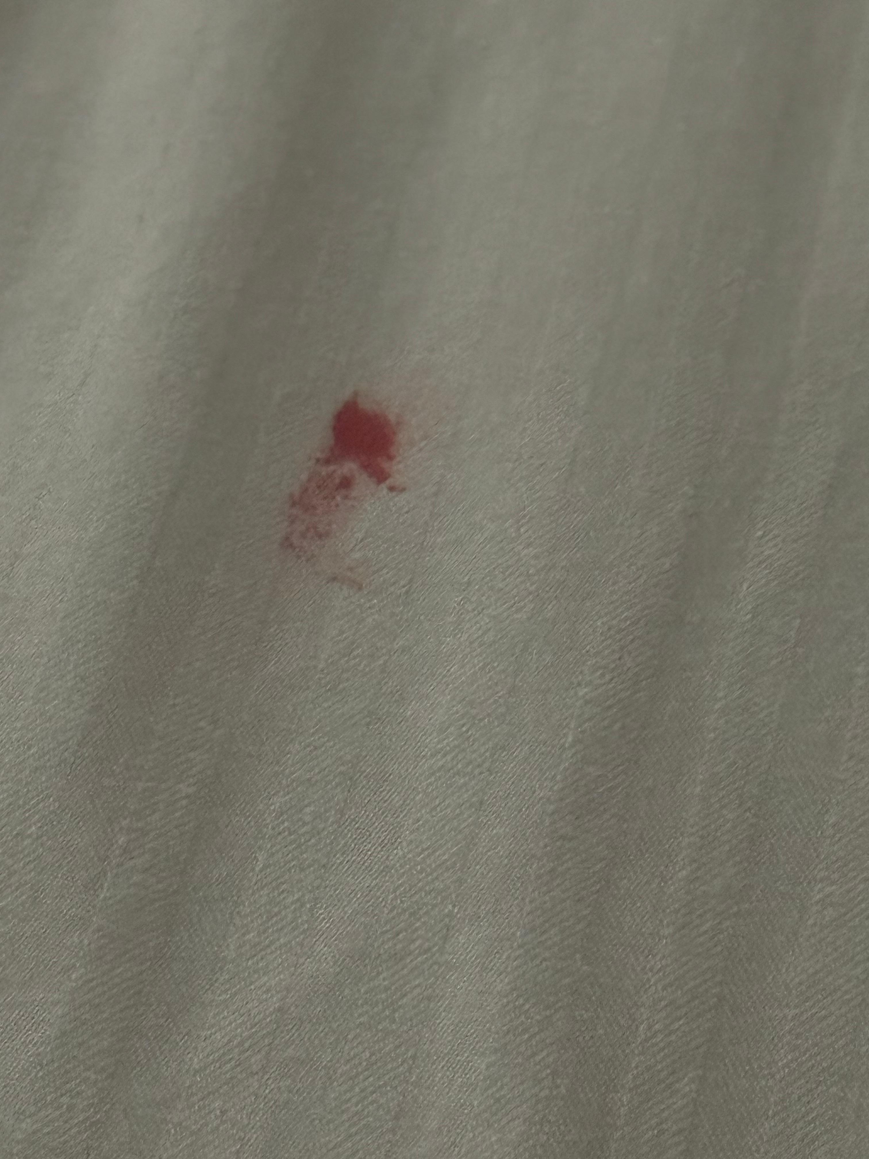 Dried up blood on blanket!!!!!