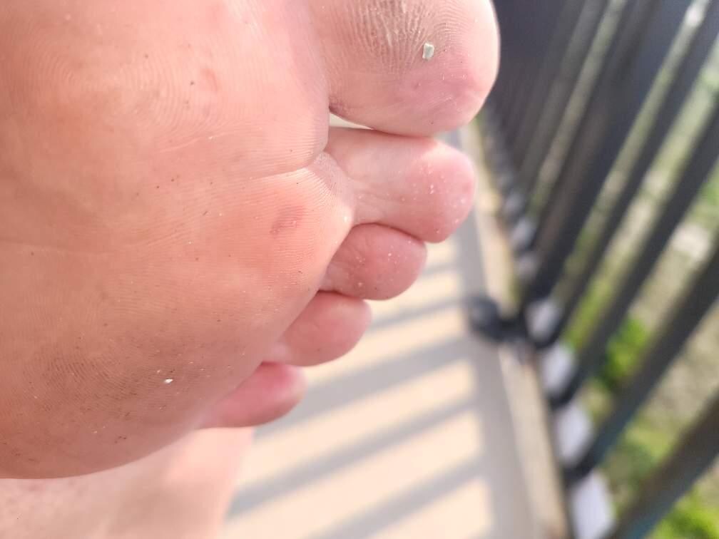 Cut on foot