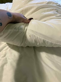 Yes that's a bed bug