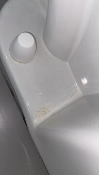Urine stain and pubic hairs on the toilet