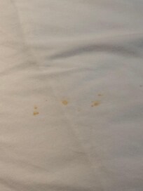 Stains on sheet