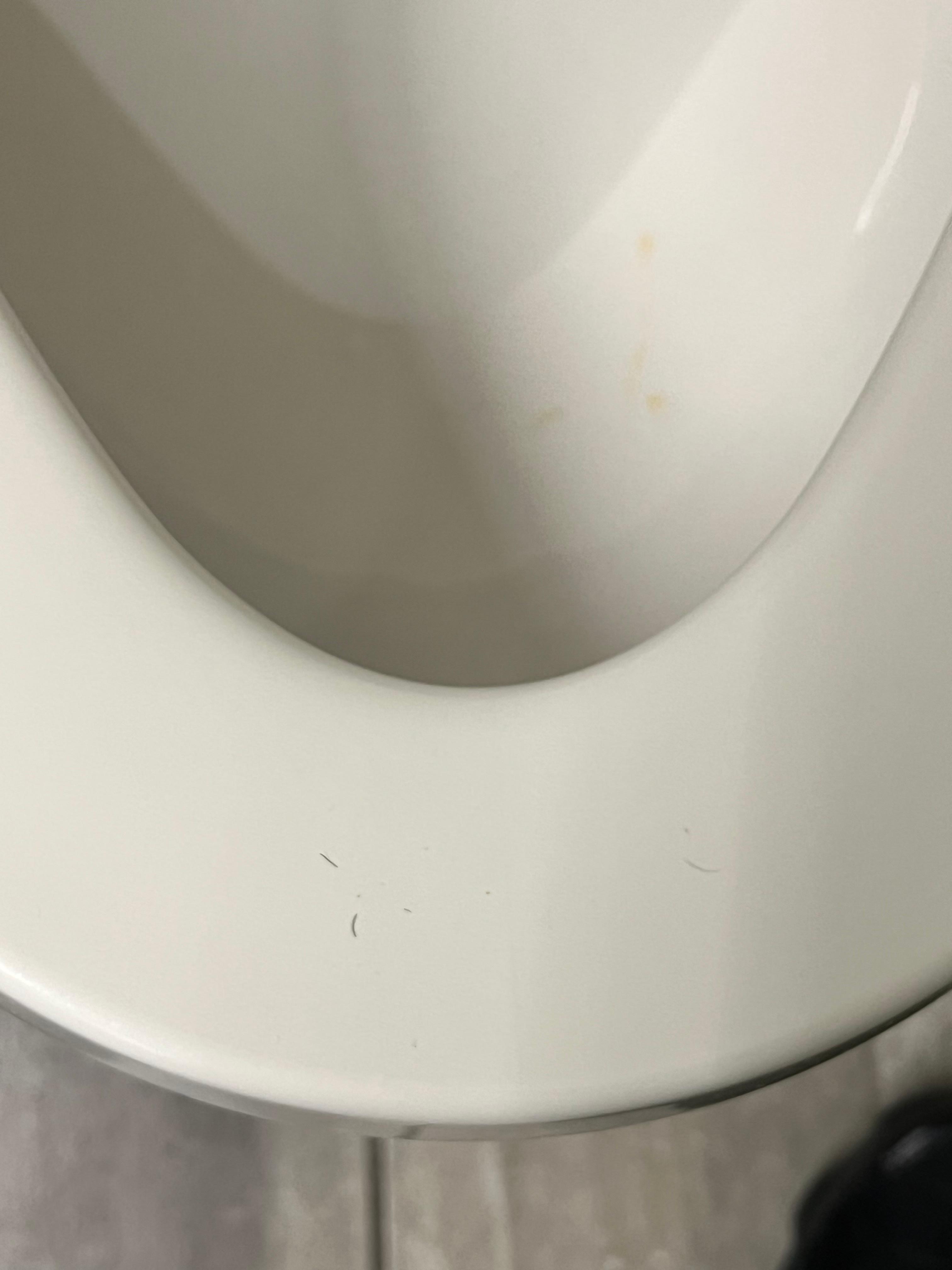 Dirty toilet