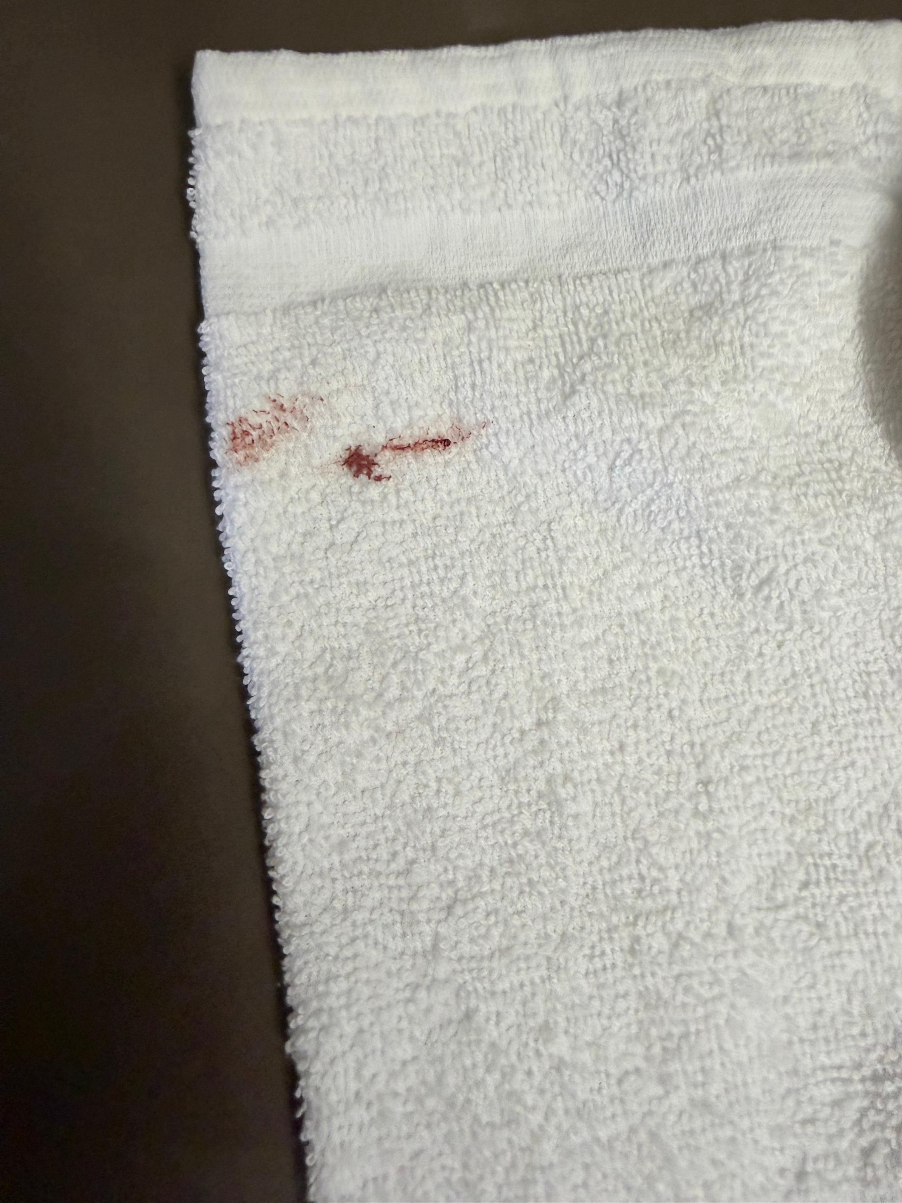 Appears to be blood on a “clean” washcloth.