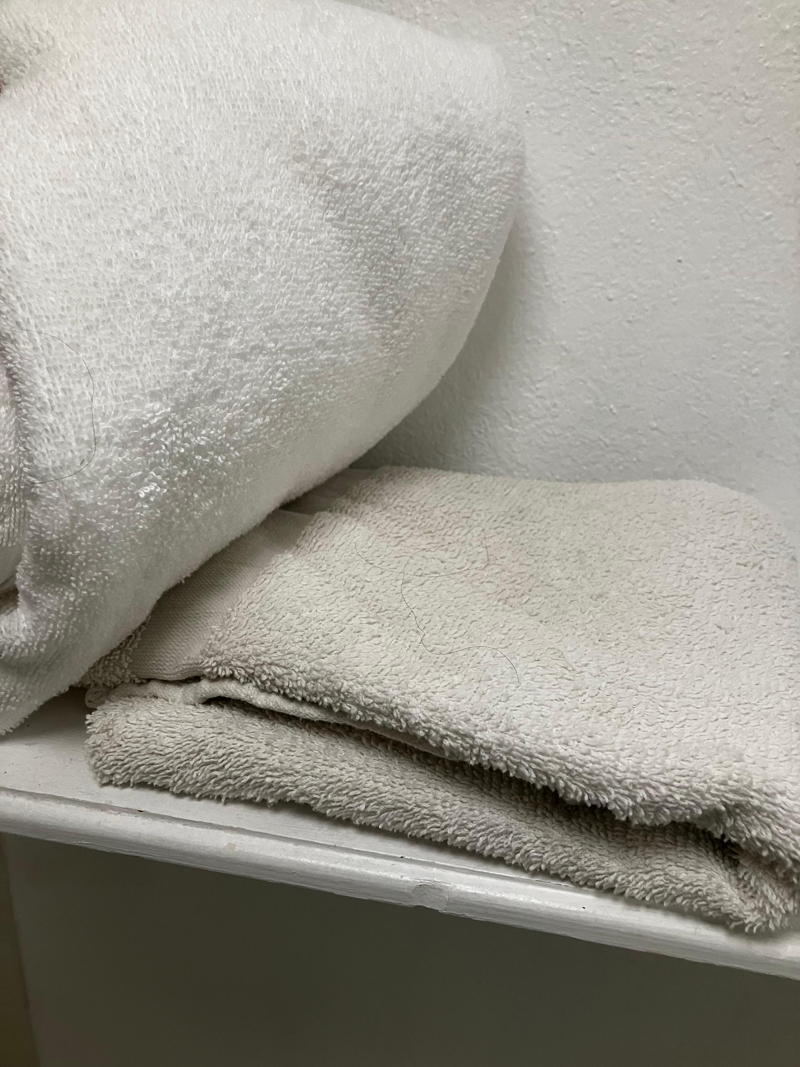 Zoom in there are hairs - gross