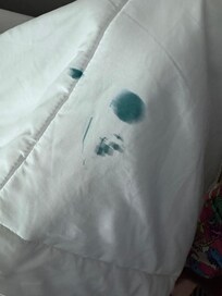 Stains on bed