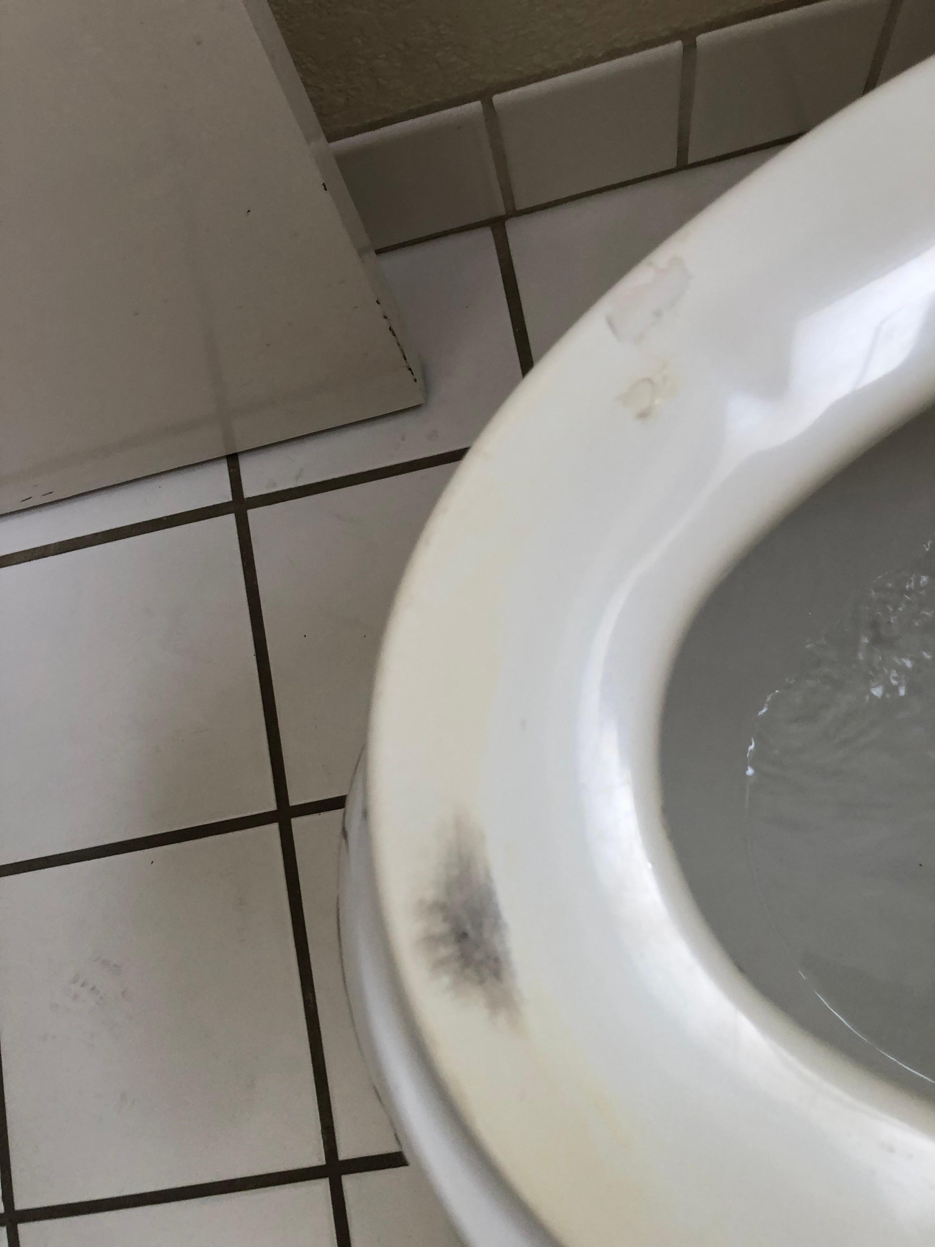 Stained toilet seat 