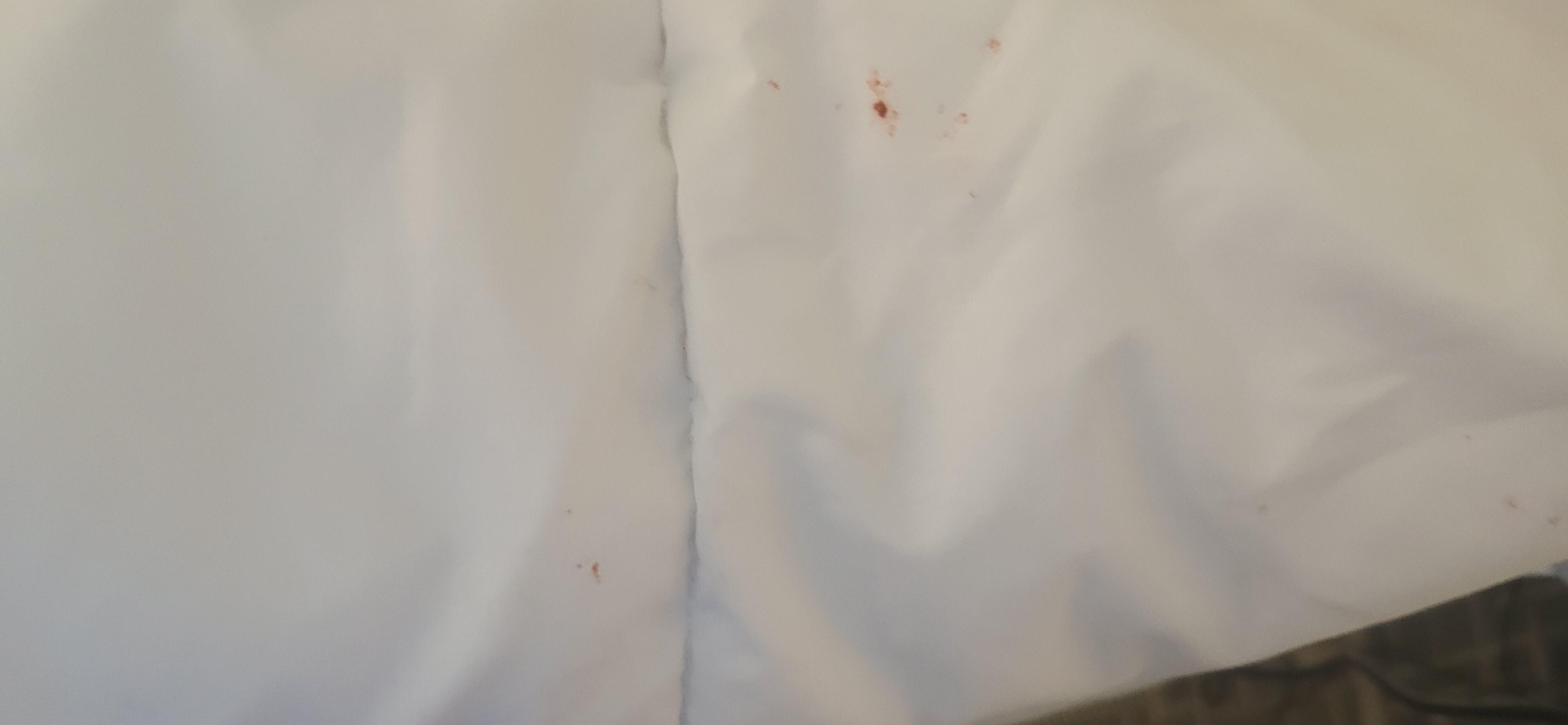 Blood stains on duvet cover