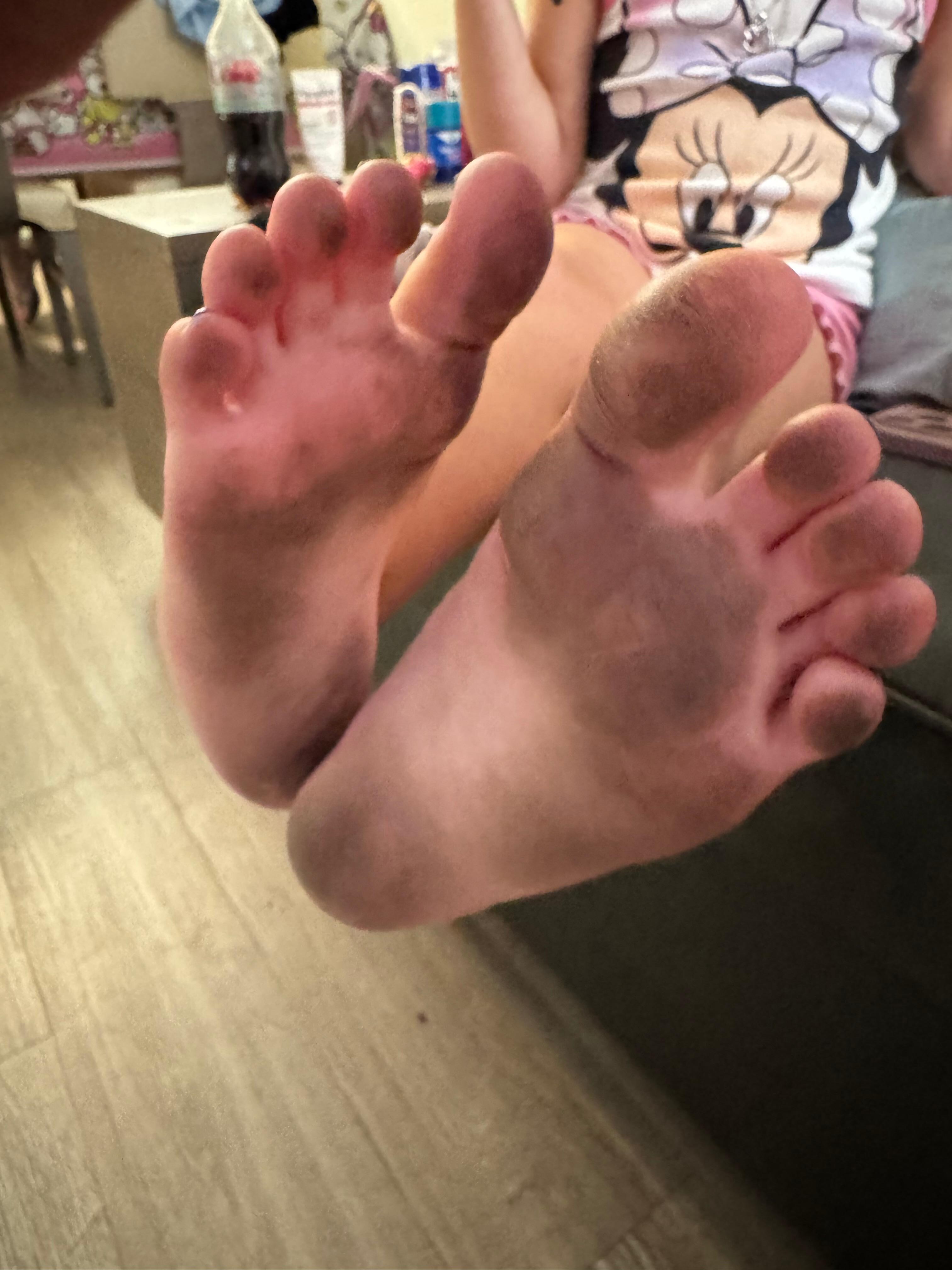 My granddaughter’s feet when first got out room. Did they really clean it.