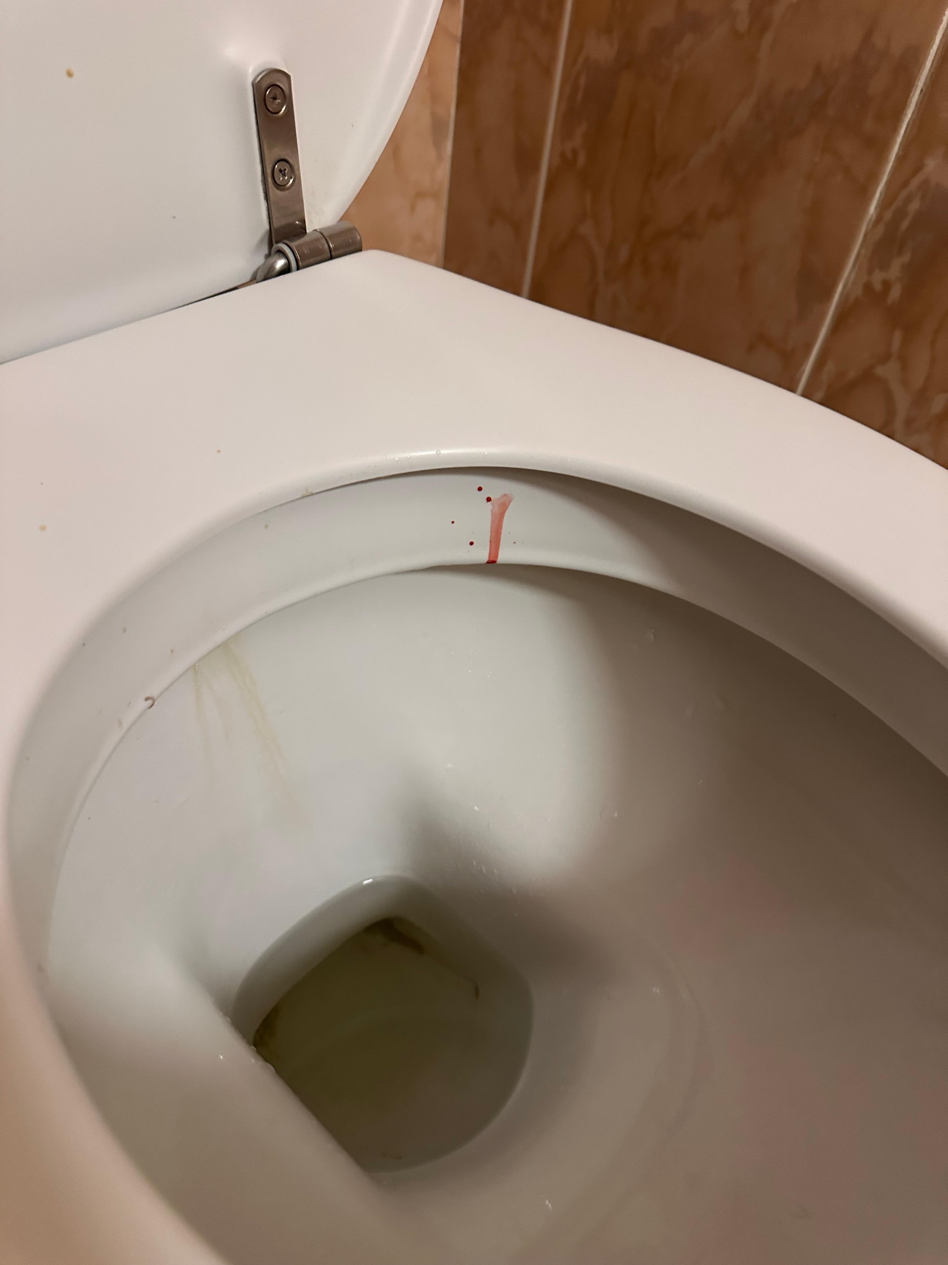 Blood on toilet 