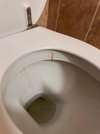 Blood on toilet