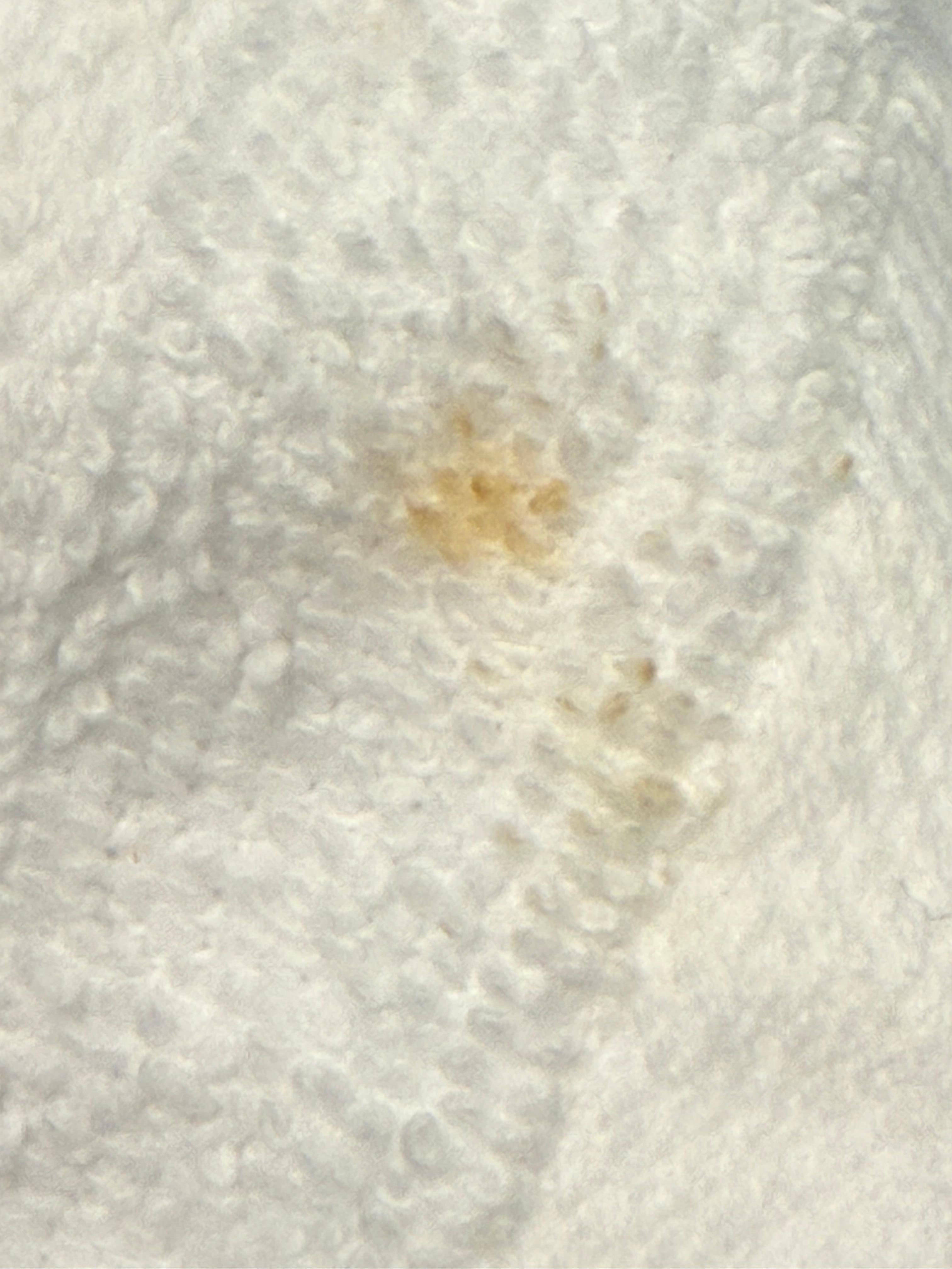 Dirty and stained wash cloth. 