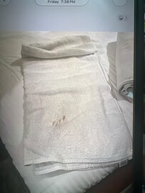 Stained towels