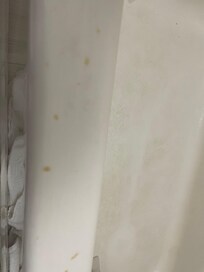 Burns all in the tub and wall