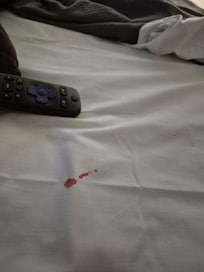 I was charged for the blood that came from their bug that I killed .