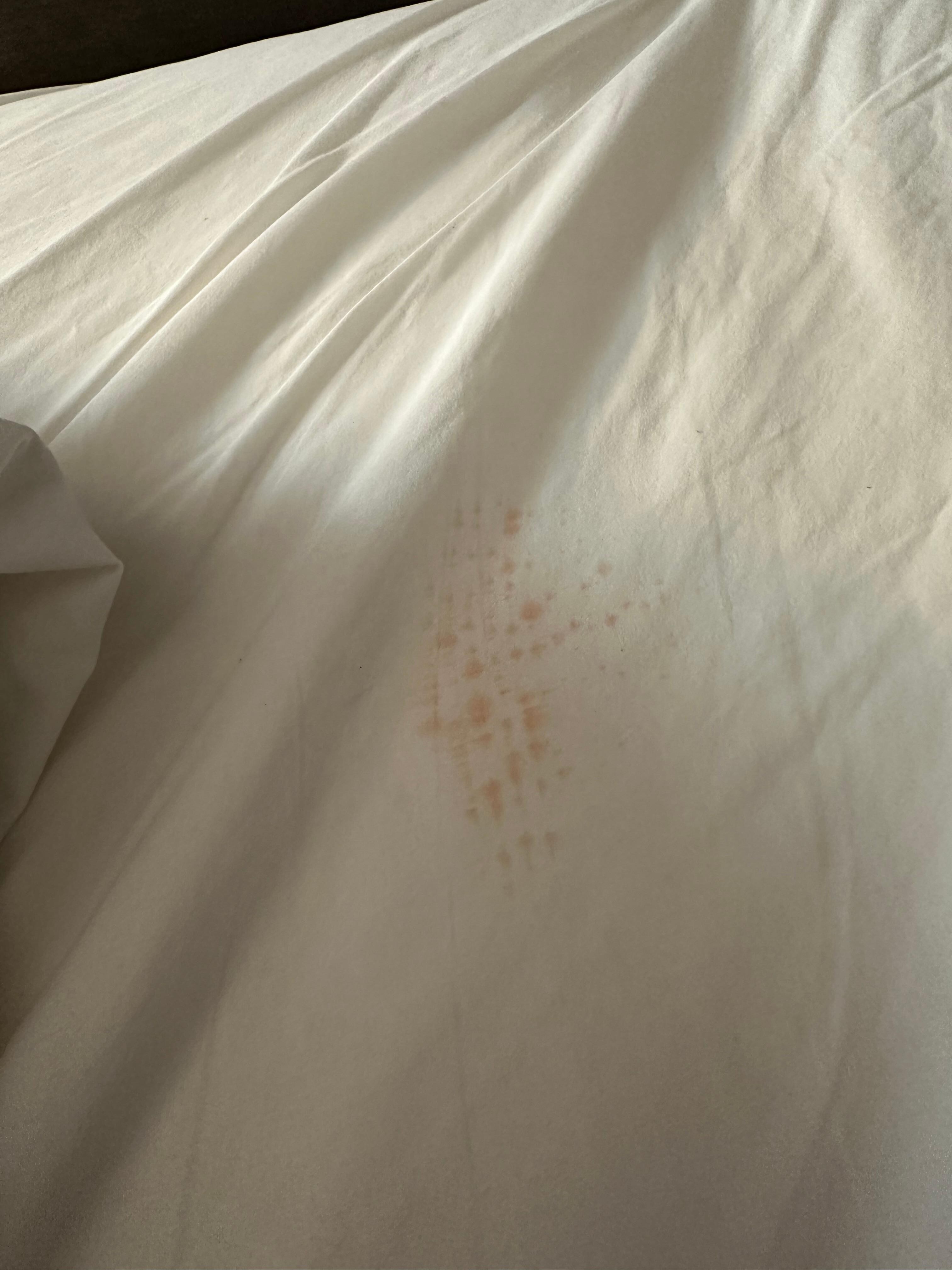 1 of many stains on sheets