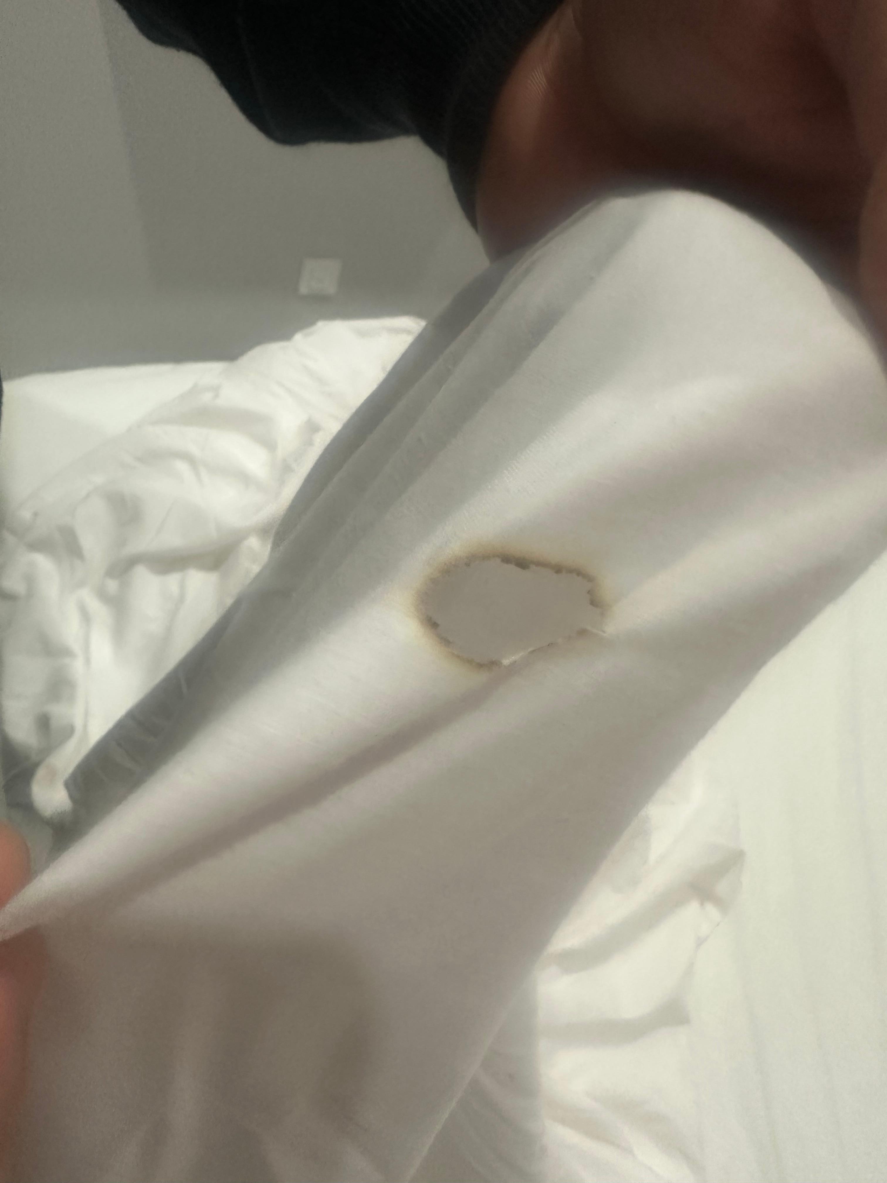 Nos encontramos en la sábana un agujero de una quemadura 