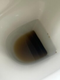 Soiled toilet in my room on arrival