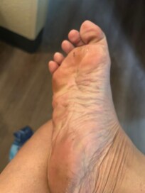 Dirty feet from hotel room floor
