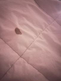 Cigarette burn on comforter