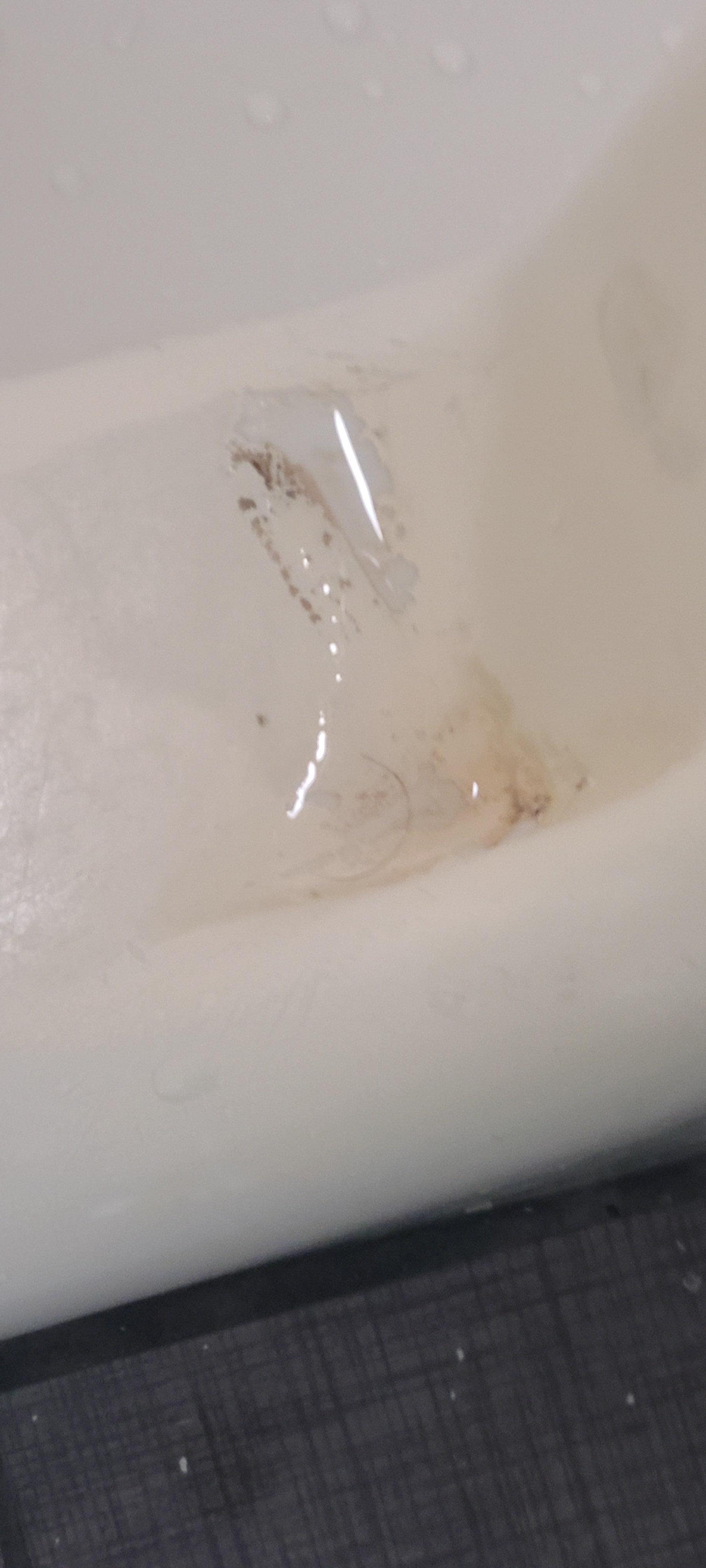 Mold around shower closer