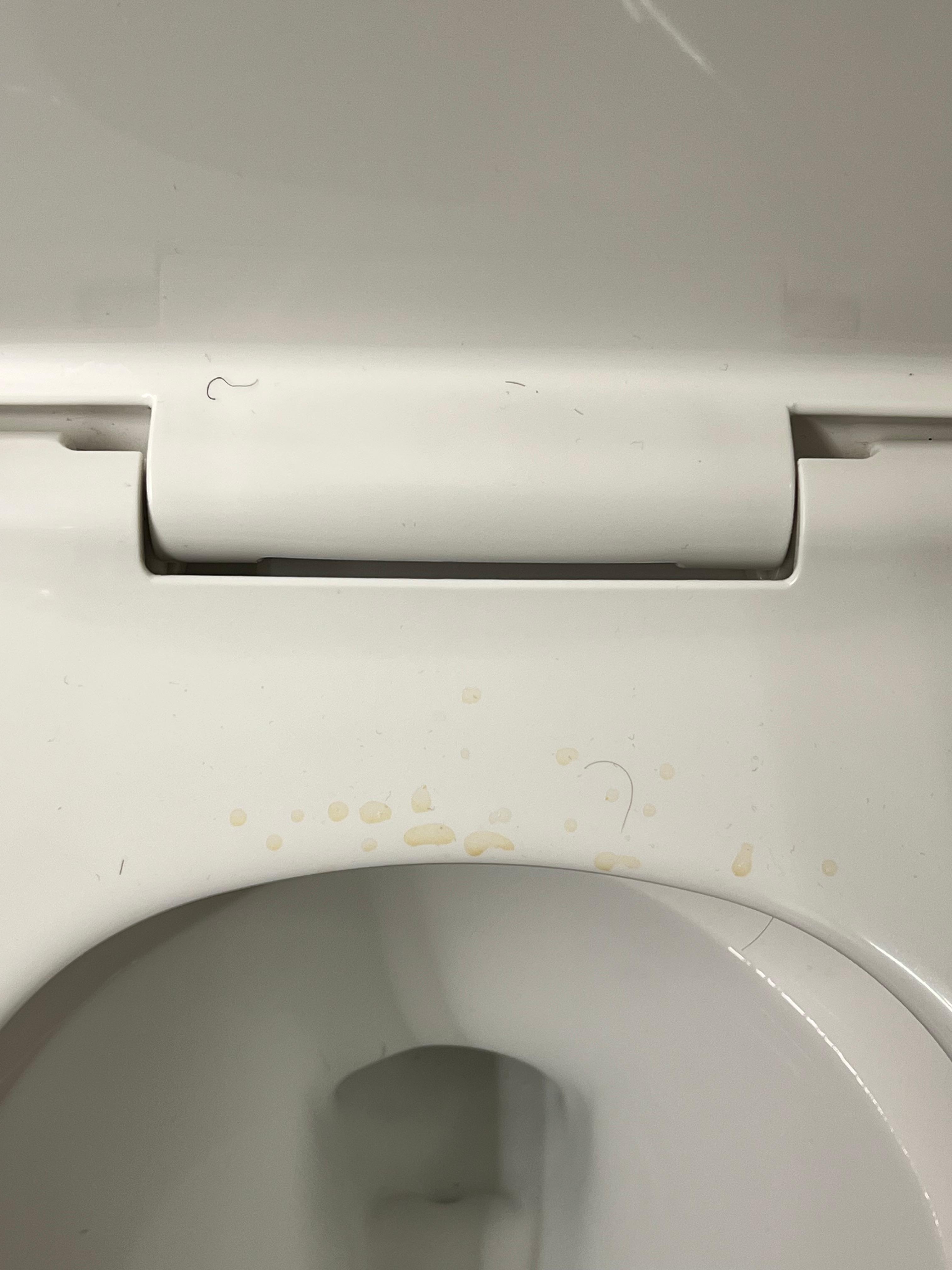 Dirty toilet 