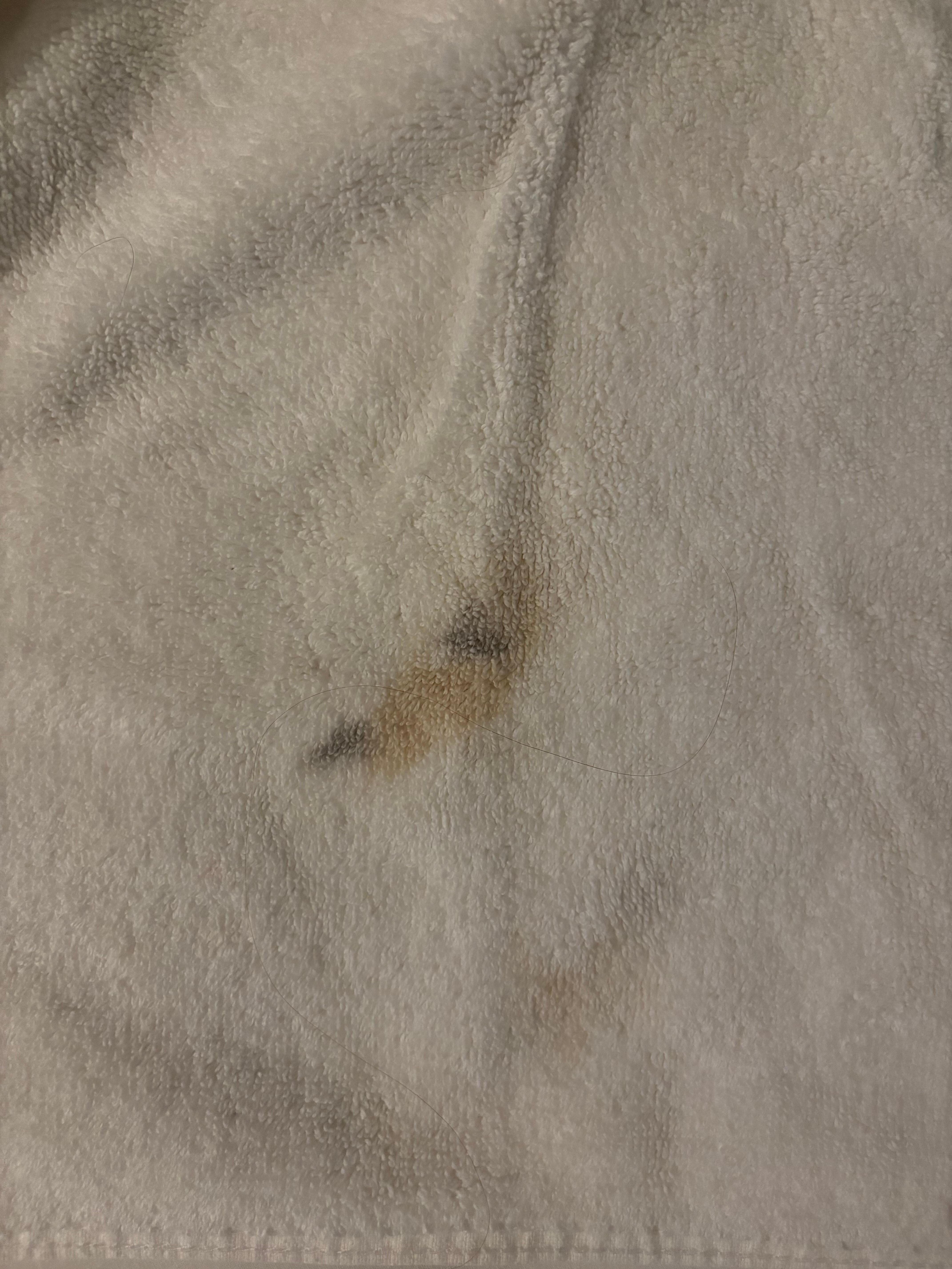 Marks on towels