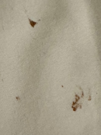 Blood stain on pillow