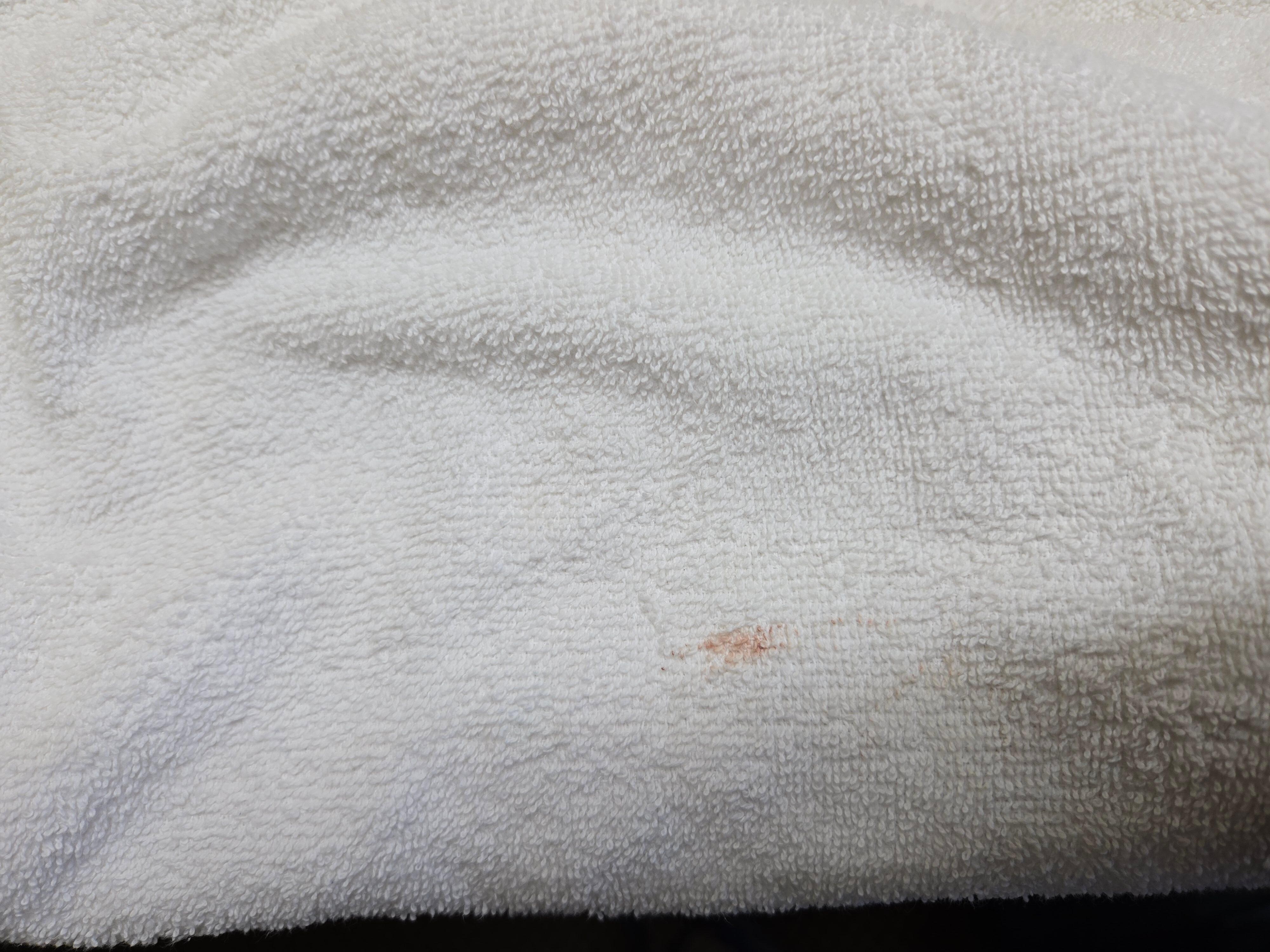 Blood stains on towel. Albeit its small, it's not mine and gross.