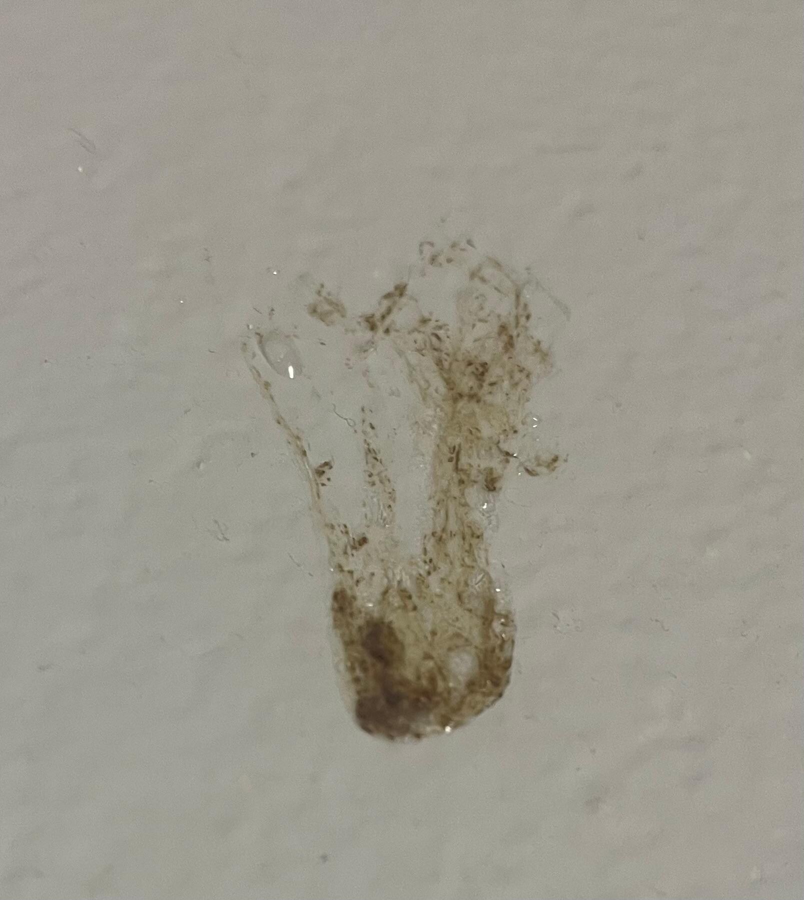 Spit on the wall