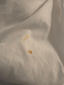 Nasty spots on sheets