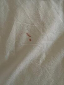 Multiple Stains on Sheets