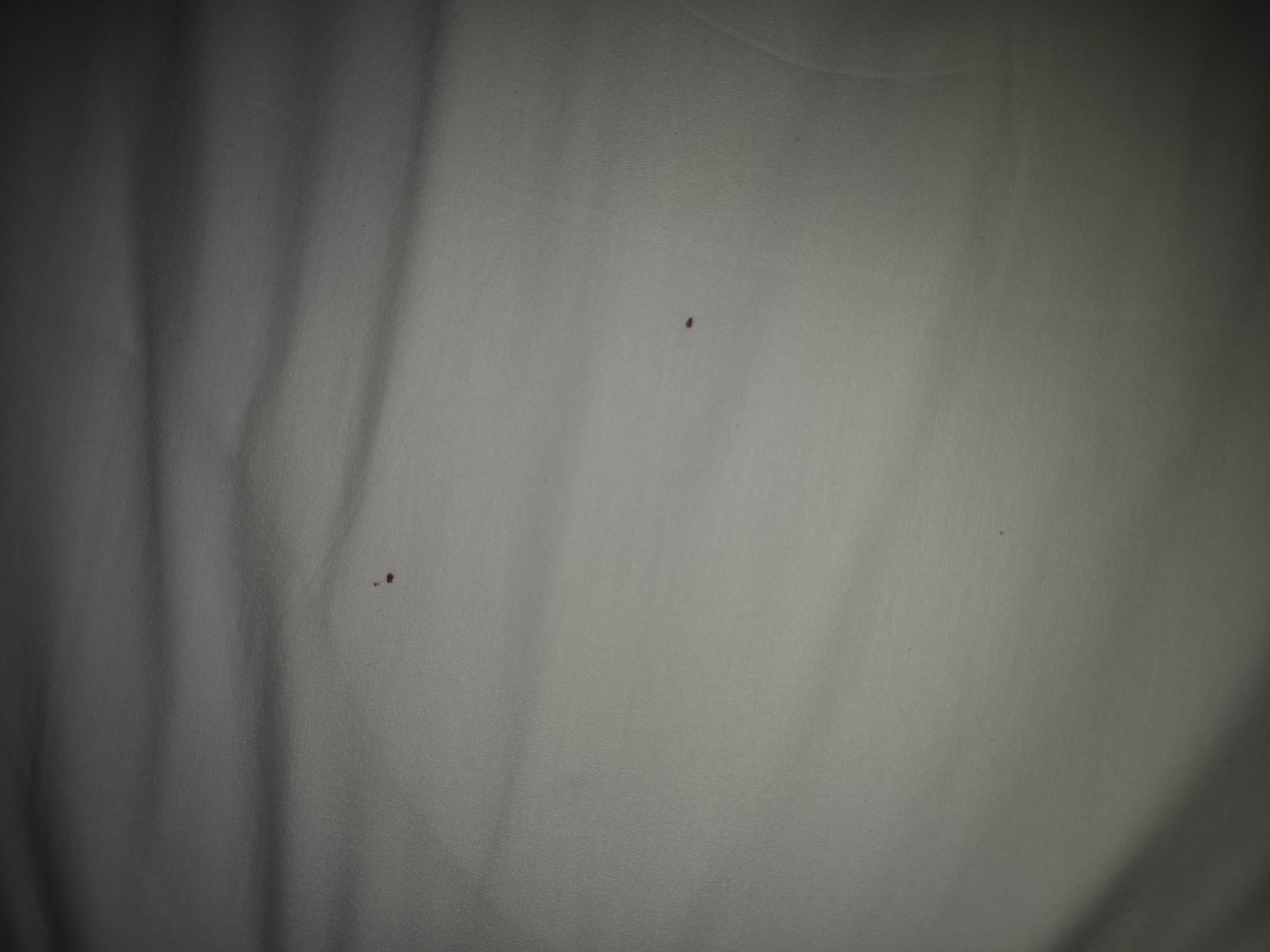 Blood spots on the sheets.