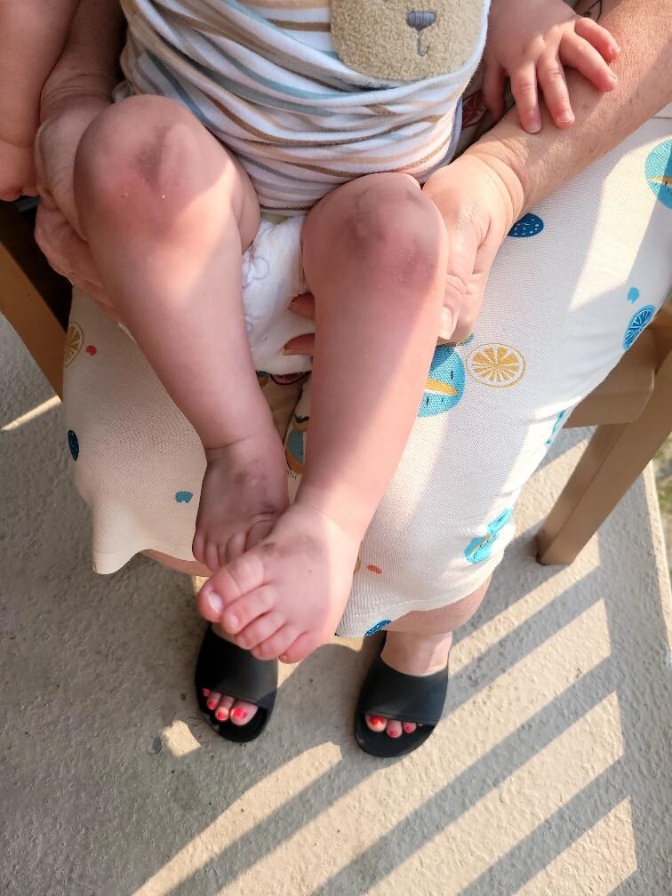 Grandsons feet and legs after crawling on the floorboards 