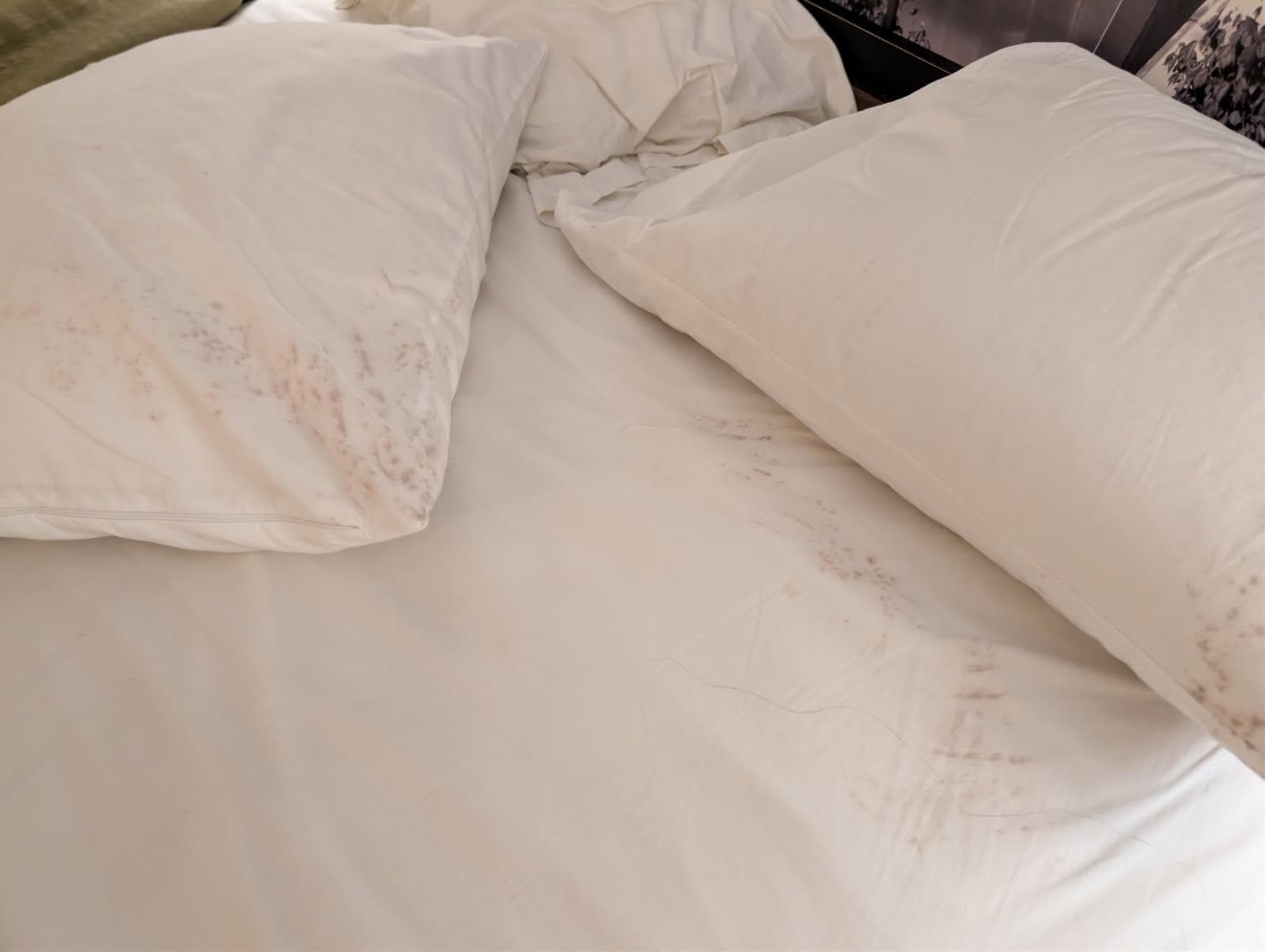 Stained sheets. Hair found in sheets. 