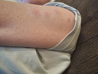 Just a few of my bites.