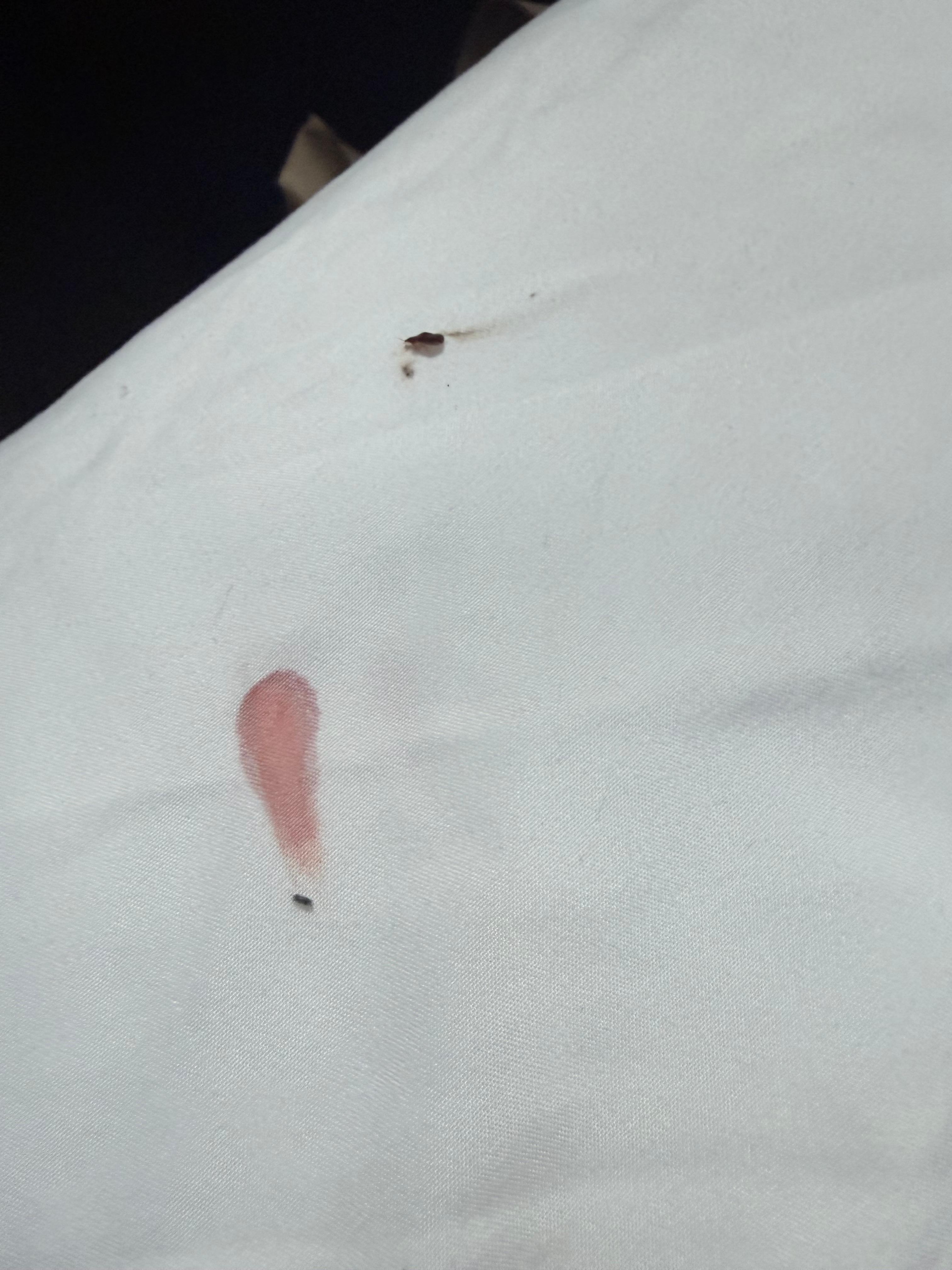 After my boyfriend smashed a bug crawling on his pillow … turned out to be a bed bug !