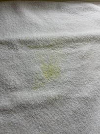 Mystery yellow goo on the bathroom towel