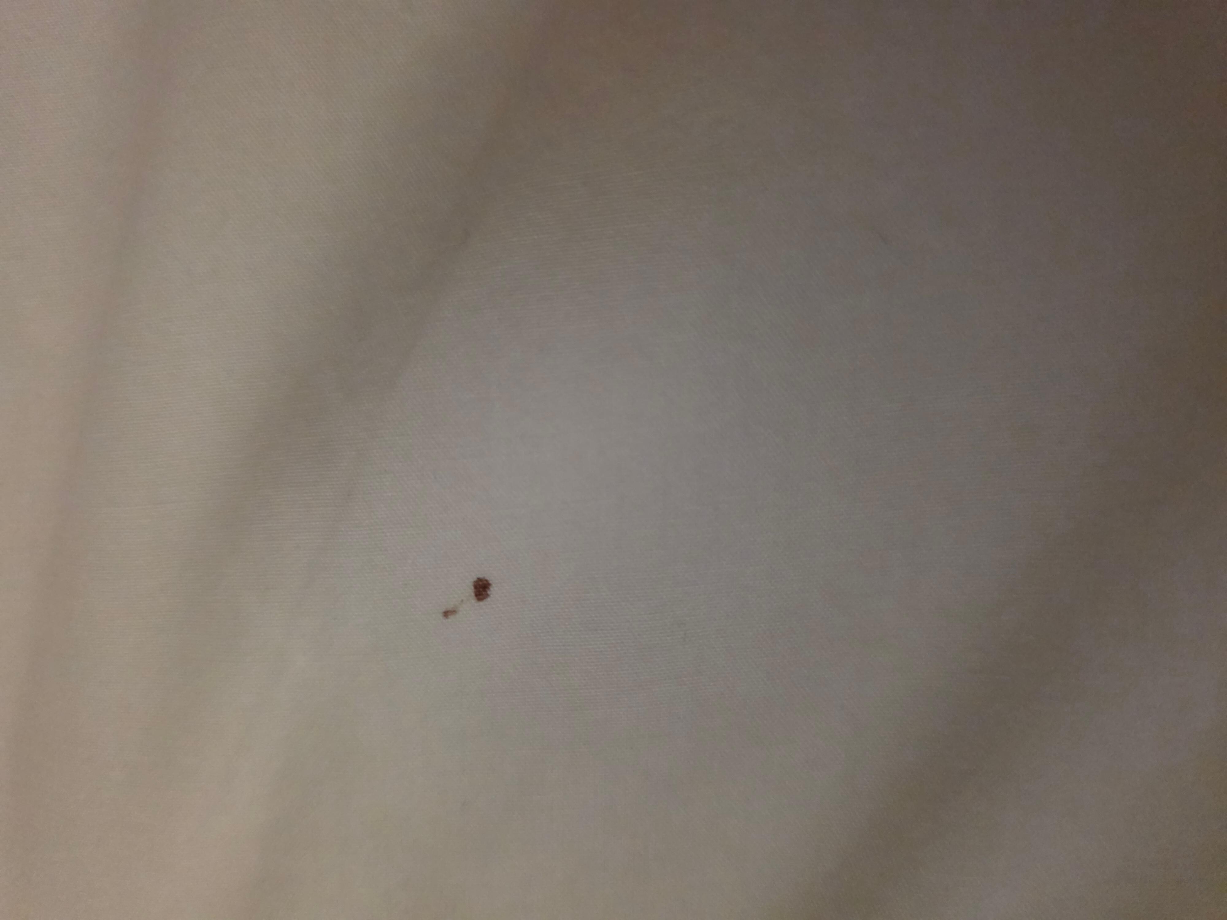 Closer look of 2 blood spots on sheets
